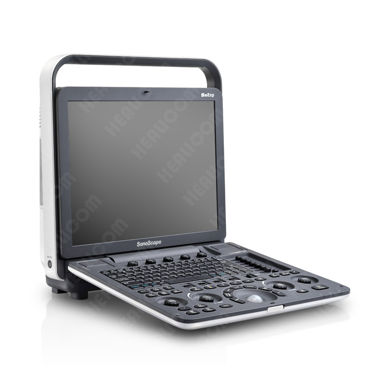 Sonoscape S8 Exp Potable 4D Color Doppler Ultrasound Machine from China ...