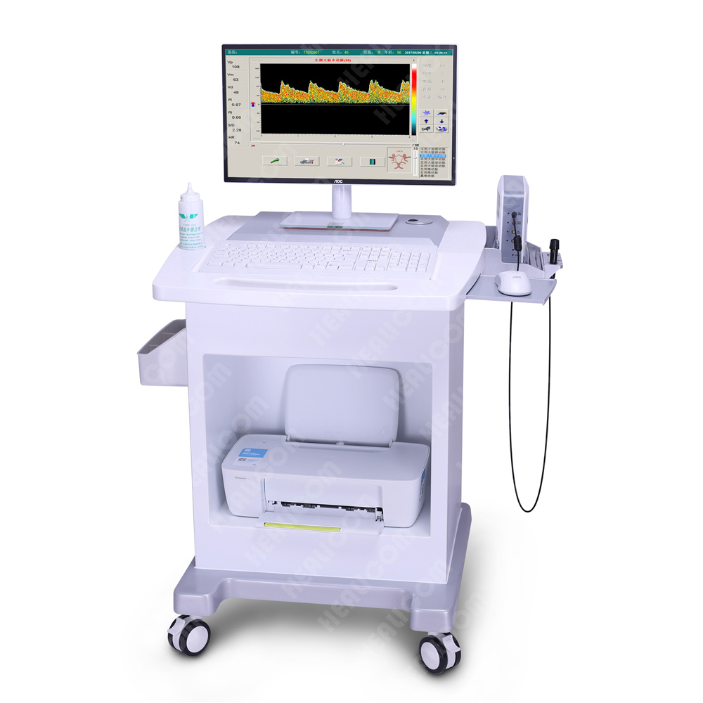 HTCD Portable Brain Disease Transcranial Color Doppler Ultrasound from ...